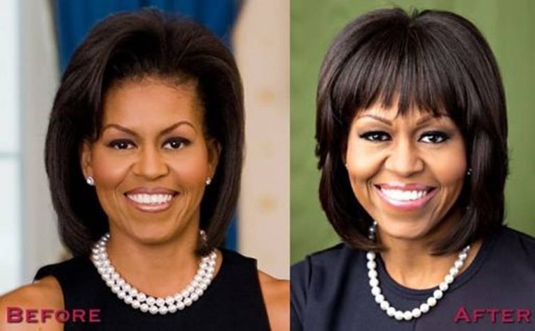 The Way She Looked: Michelle Obama’s Before and After Plastic Surgery ...