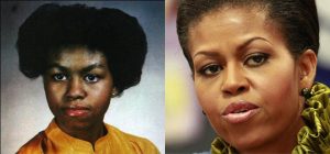 The Way She Looked: Michelle Obama’s Before and After Plastic Surgery ...